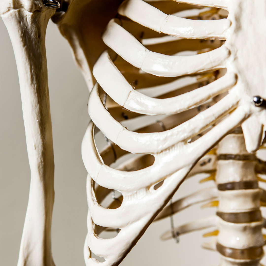 Understanding Slipped Rib: Causes, Symptoms, Treatment, and How ...