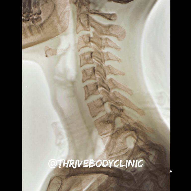 Understanding Facet Joints: Why They Can Hurt and How to Relieve the ...